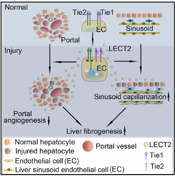 CELL:南方医团队发现LECT2可作为肝纤维化治疗靶标_美必思医学编译