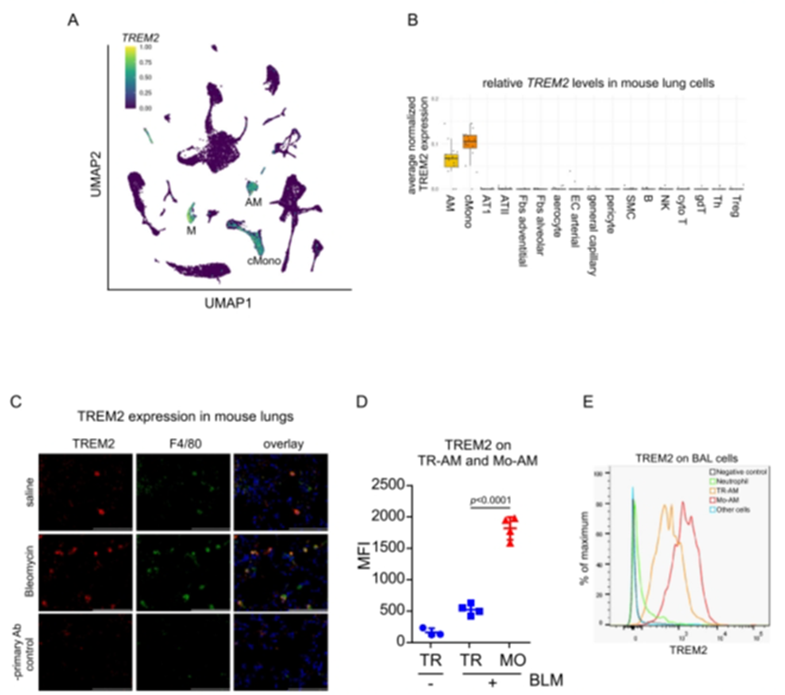 Nature子刊：TREM2通过调控肺泡巨噬细胞活性促进肺_美必思医学编译