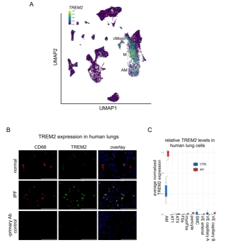 Nature子刊：TREM2通过调控肺泡巨噬细胞活性促进肺_美必思医学编译