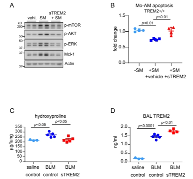Nature子刊：TREM2通过调控肺泡巨噬细胞活性促进肺_美必思医学编译