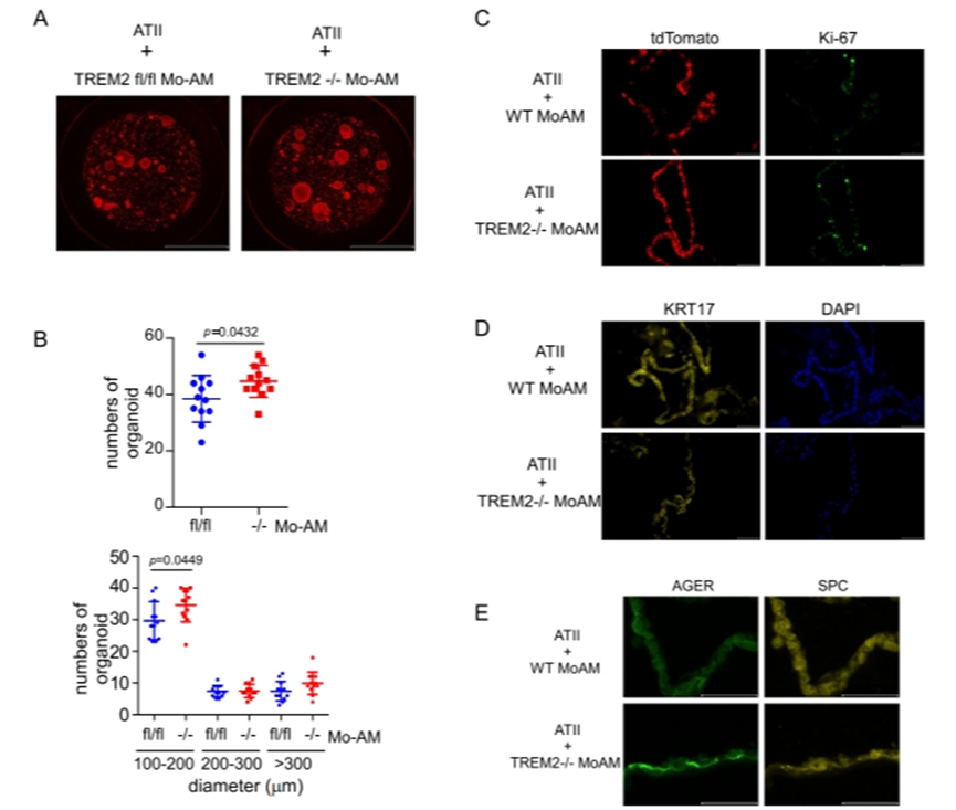Nature子刊：TREM2通过调控肺泡巨噬细胞活性促进肺_美必思医学编译