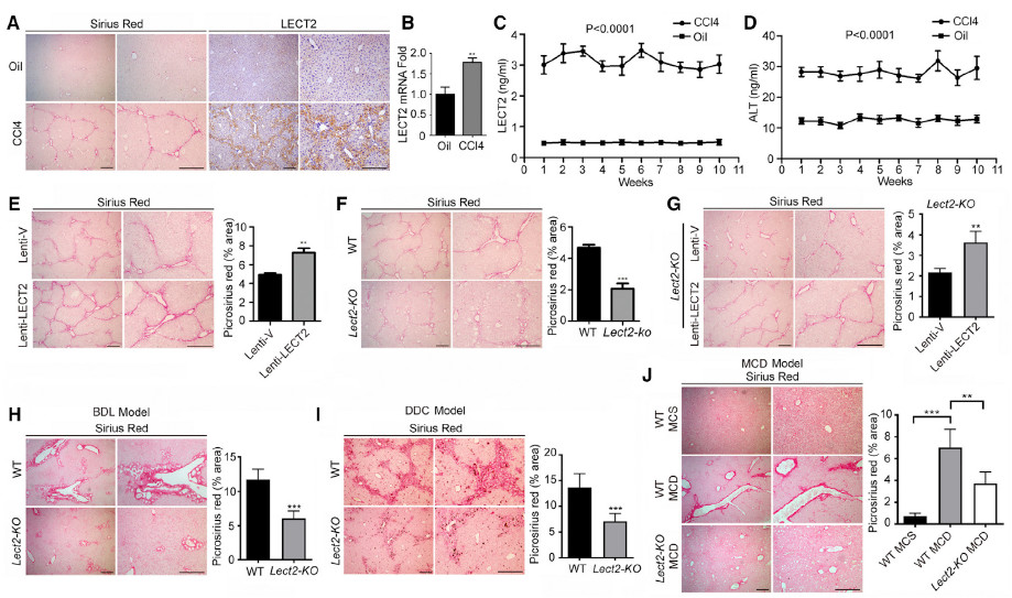 CELL:南方医团队发现LECT2可作为肝纤维化治疗靶标_美必思医学编译