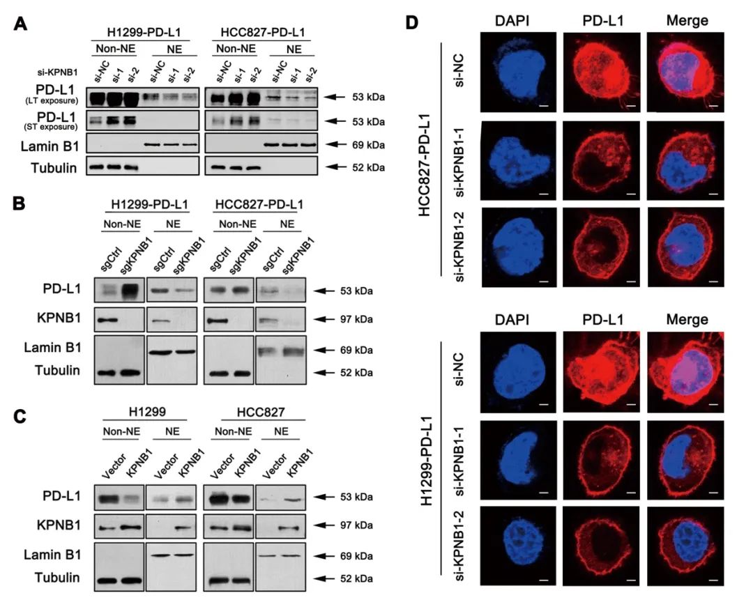 CELL DEATH DIFFER：揭示PD-L1入核后促进肺癌的新机制_美必思医学编译