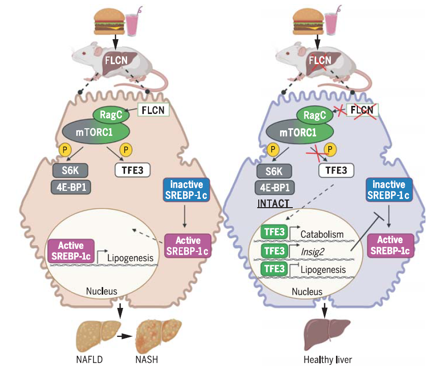 Science:选择性抑制mTORC1可有效抑制非酒精性脂肪肝_美必思医学编译