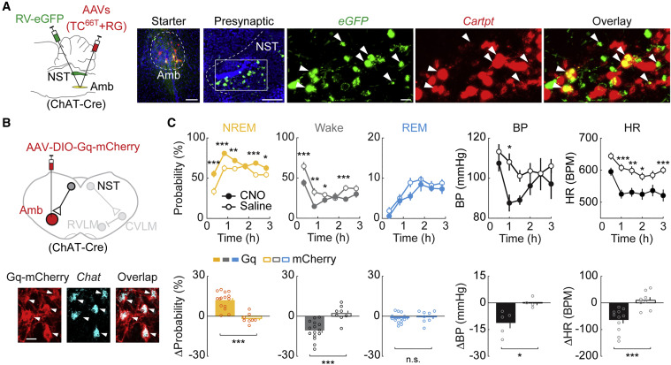 Neuron: 心血管压力反射回路在睡眠控制中的作用_美必思医学编译