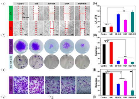 解析什么是细胞迁移与侵袭_美必思医学编译