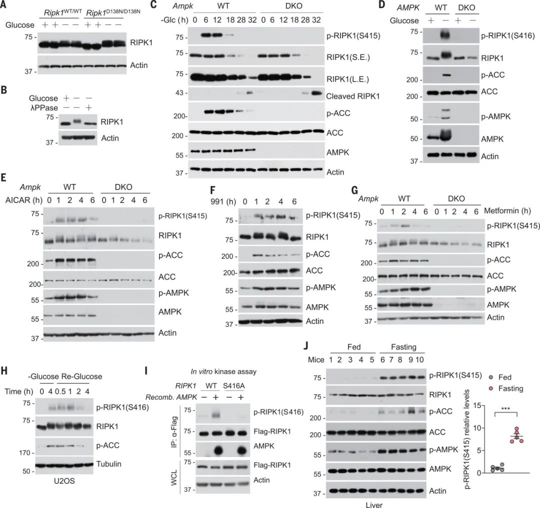 Science:AMPK介导RIPK1磷酸化调控代谢应激下细胞存亡_美必思医学编译