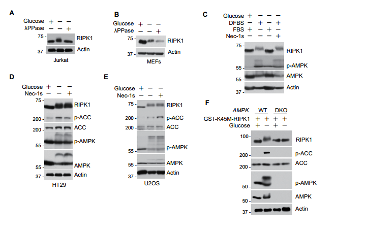 Science:AMPK介导RIPK1磷酸化调控代谢应激下细胞存亡_美必思医学编译