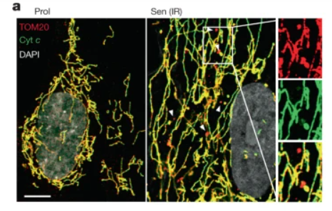 Nature:线粒体协调衰老相关的细胞凋亡_美必思医学编译