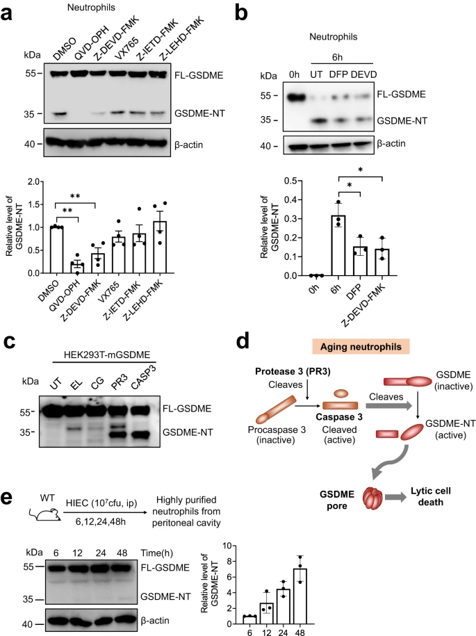 Nature子刊:GSDME调控中性粒细胞死亡影响炎症反应_美必思医学编译