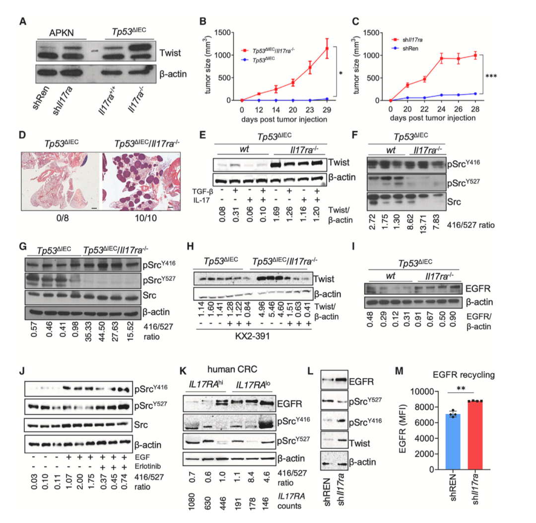 Immunity:IL-17RA通路在结直肠癌中的双重作用_美必思医学编译
